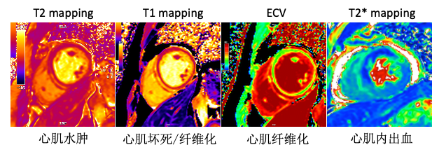 中国医学科学院阜外医院